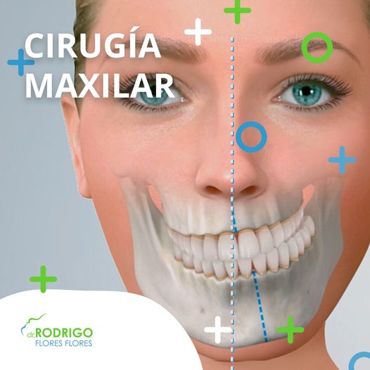 ¿QUE HACE UN CIRUJANO MAXILOFACIAL? ¿QUE HACE UN CIRUJANO MAXILOFACIAL?