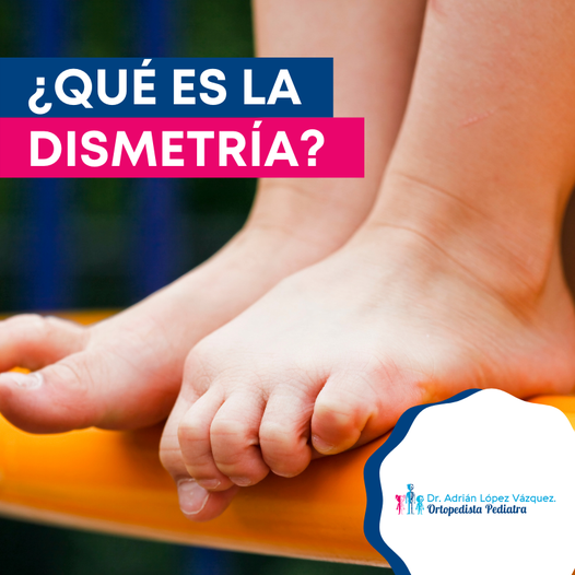 ¿QUE ES LA DISMETRIA?